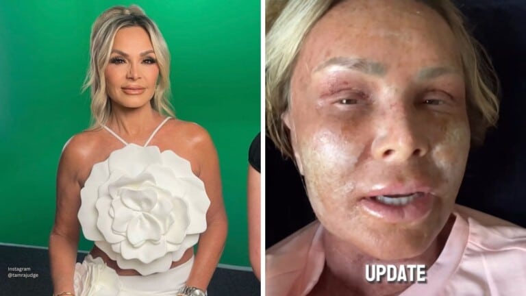 Tamra's Mom Joked About Her Cosmetic Work: RHOCTamra Judge Joked She ...
