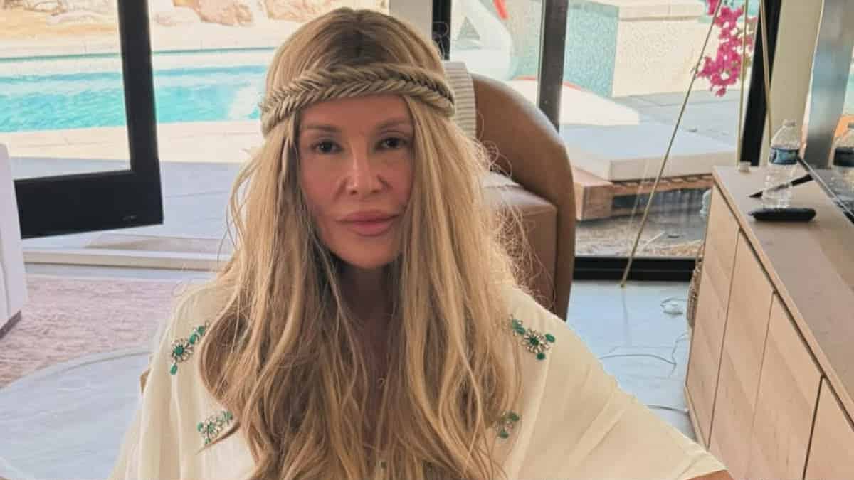 Brandi Glanville Has a Diagnosis After Suffering ‘Face Parasite ...