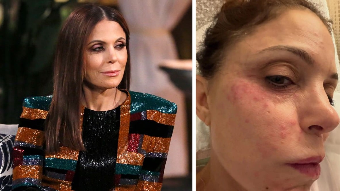 Bethenny Frankel Contracted Bacterial Infection in St. Barths - Taste ...